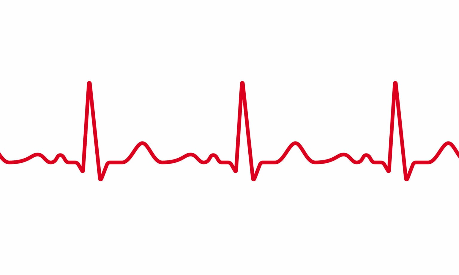 Understanding Heart Rate Changes: Stroke Volume & Adrenaline